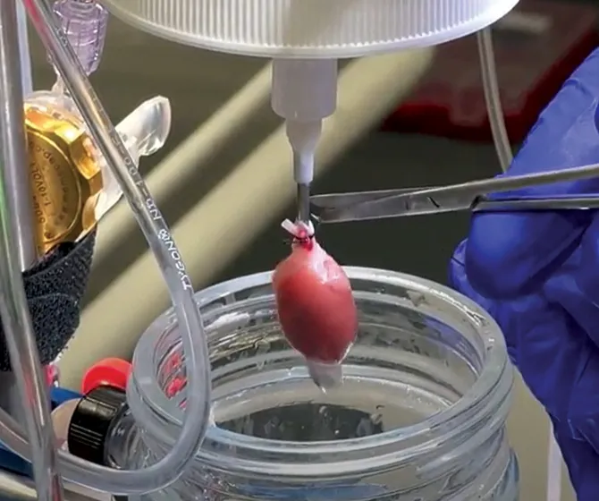 Langendorff Isolated Heart Perfusion Technique | ADInstruments